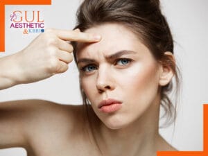 Why Is My Forehead So Oily? Causes & Solutions - Gul Aesthetic